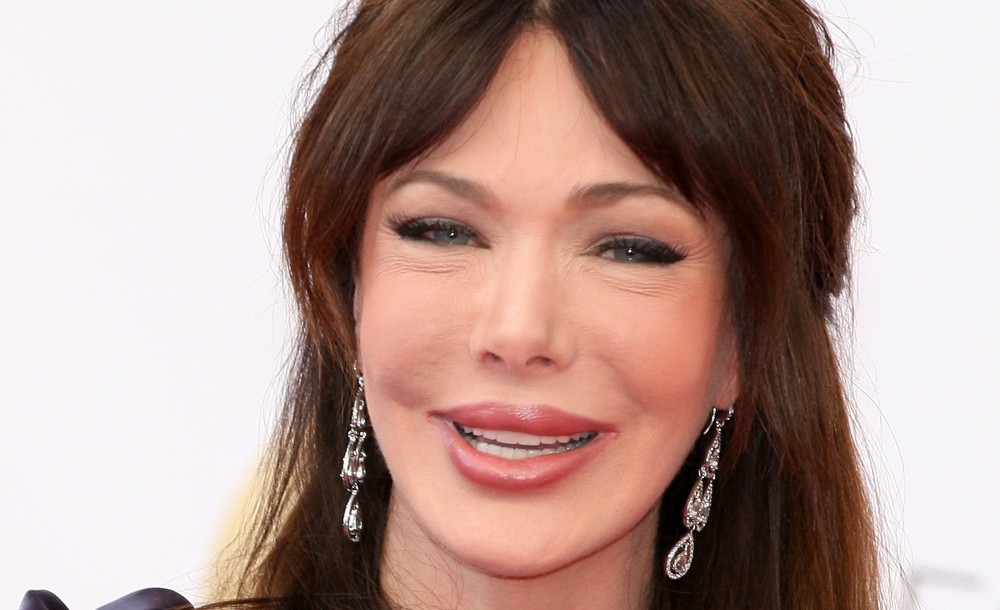 Taylor van The Bold and the Beautiful onherkenbaar na plastische ...