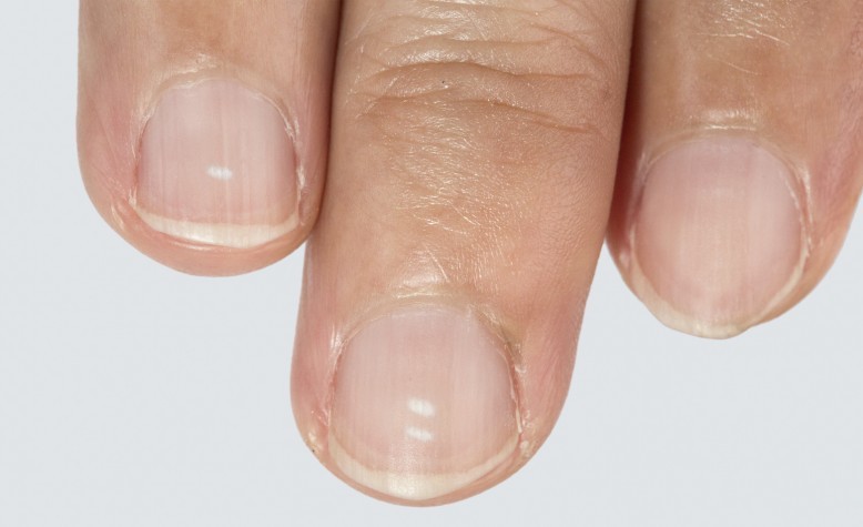 Wat de witte vlekjes op je nagels betekenen | Beau Monde